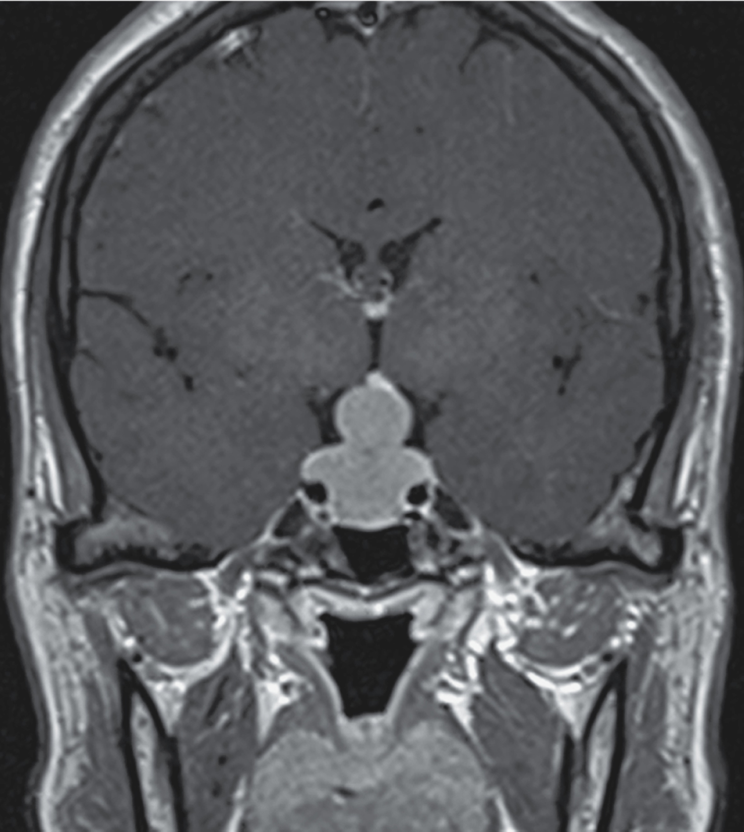 Image Challenge | The New England Journal of Medicine