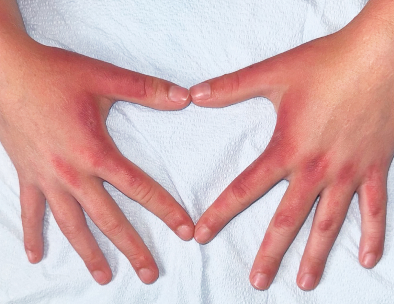 Image Challenge | The New England Journal of Medicine