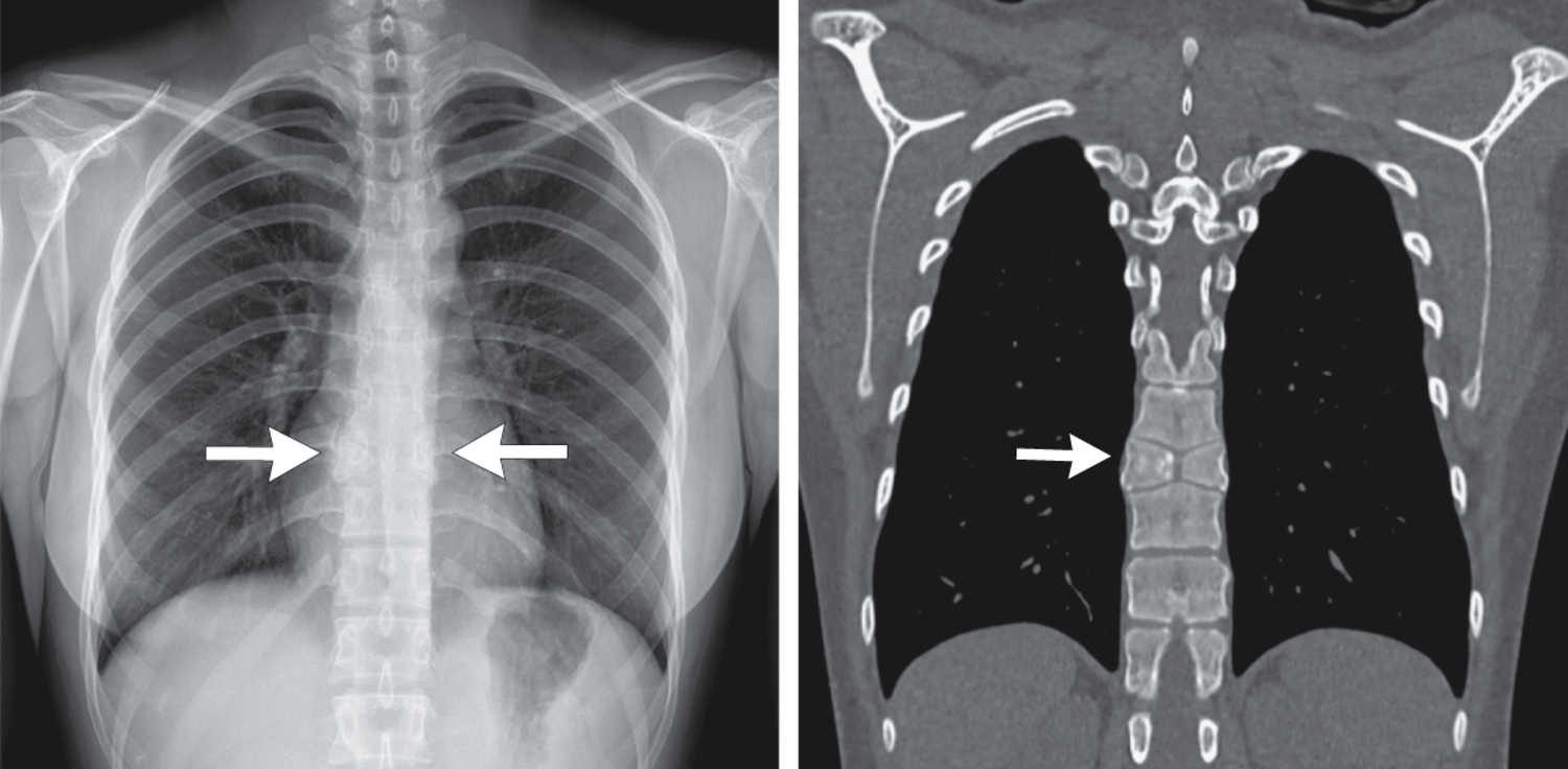 Image Challenge | The New England Journal of Medicine
