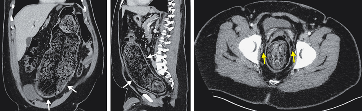 Image Challenge | The New England Journal of Medicine